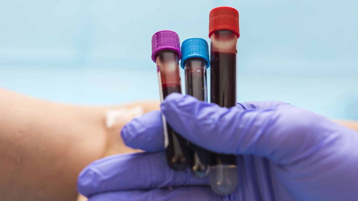 World's Rarest Blood Type May Soon Be Lab-Grown